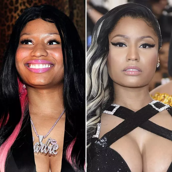 Chirurgie plastique Nicki Minaj