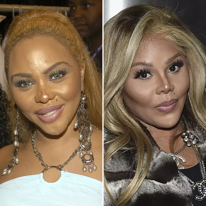 Cirurgia plástica lil kim cópia 15