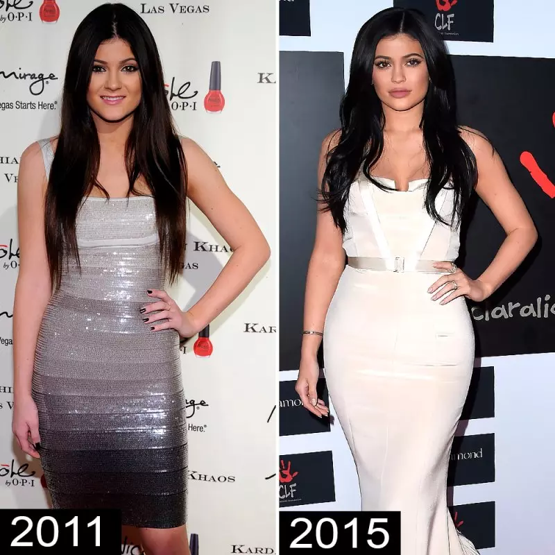 Preobrazba Kylie Jenner