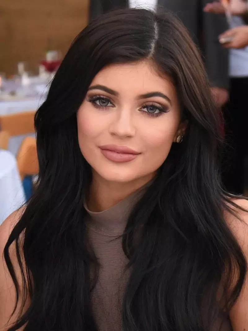 Kirurgji plastike e buzëve Kylie jenner