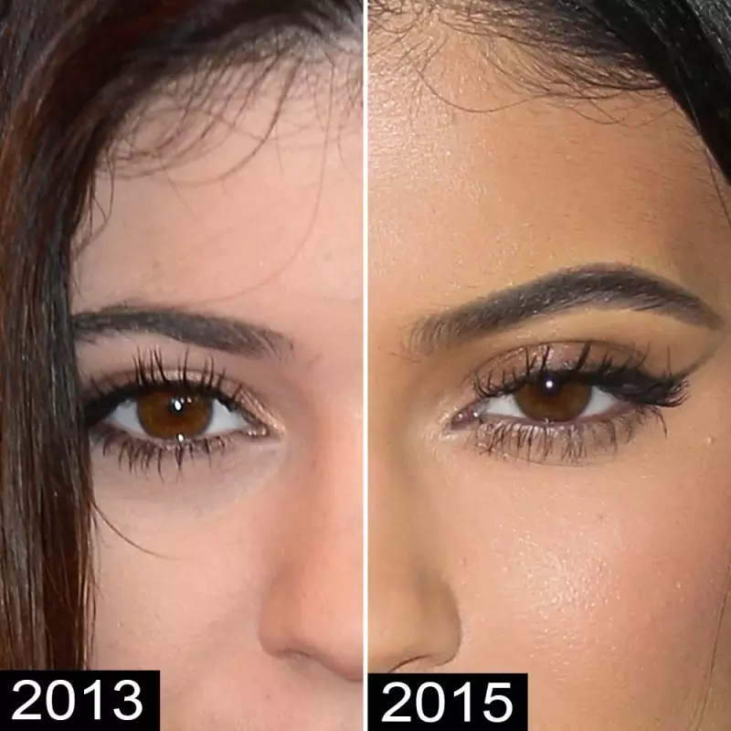 Ollos de Kylie Jenner