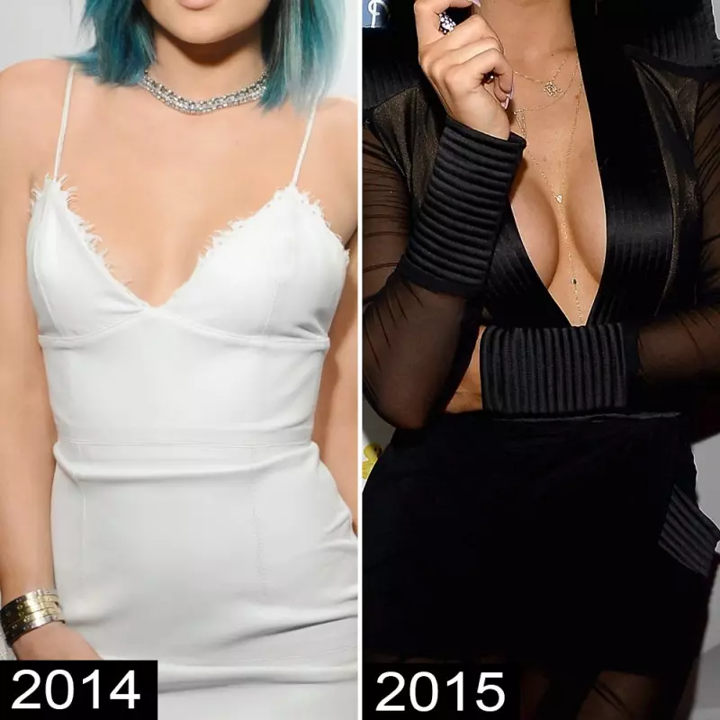 ដើមទ្រូង Kylie jenner