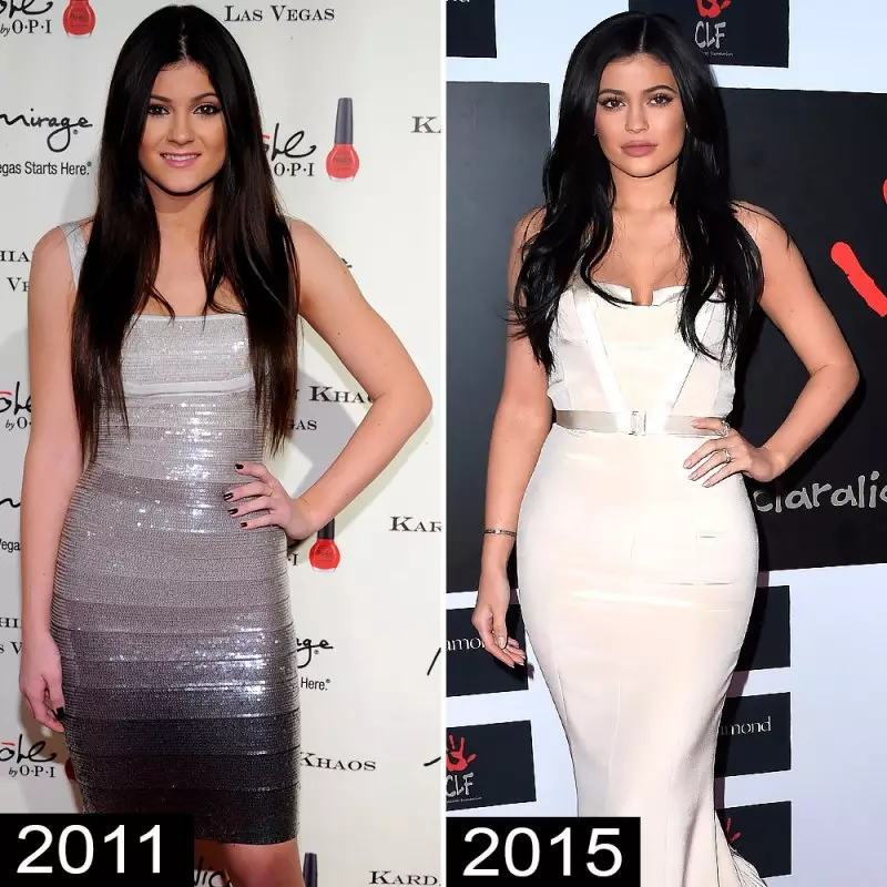 ការផ្លាស់ប្តូរ Kylie jenner