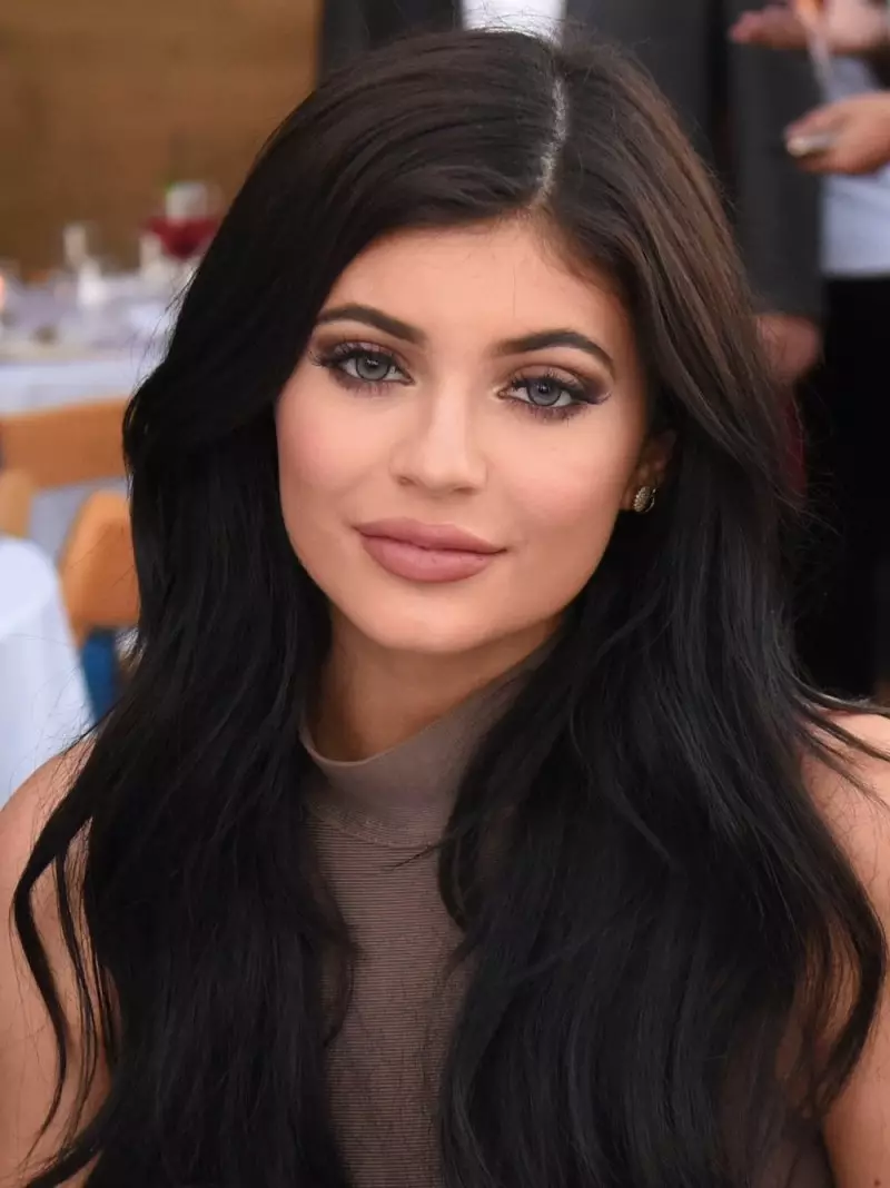 Kylie jennerin huulten plastiikkakirurgia
