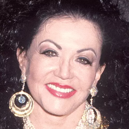 Kusintha kwa opaleshoni ya pulasitiki ya Jackie stallone