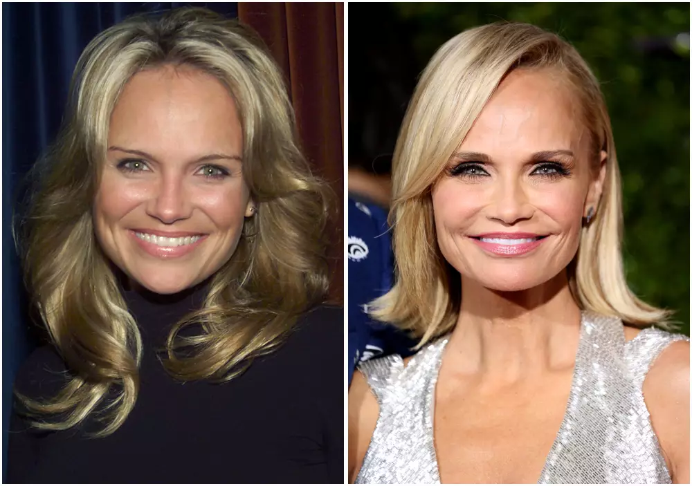 Kristin Chenoweth cirurgia plàstica