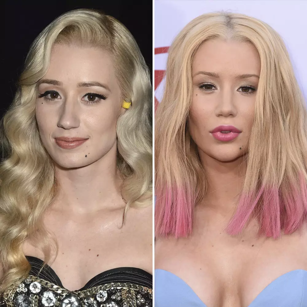 Iggy azalea प्लास्टिक सर्जरी