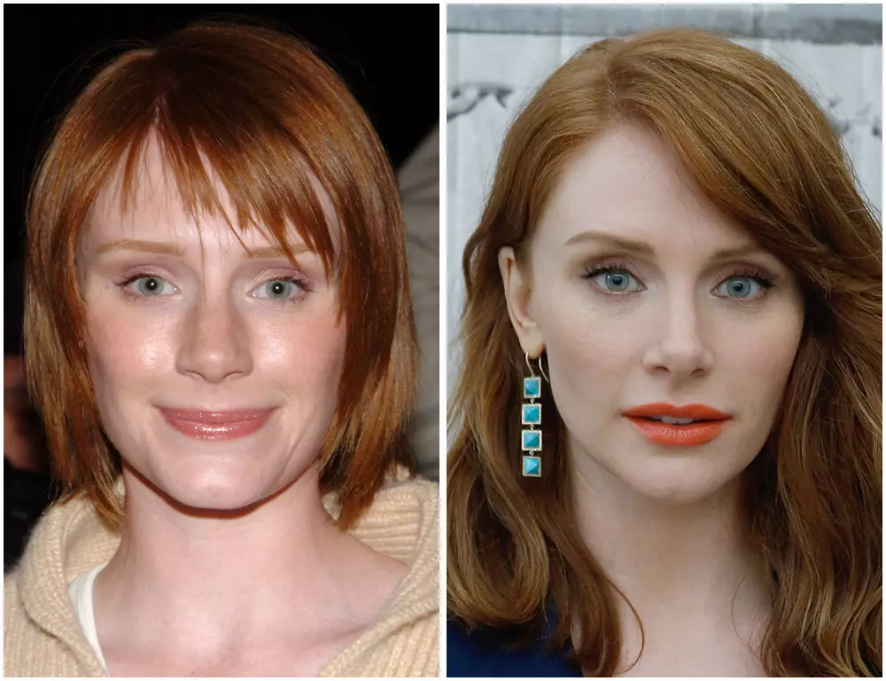 Cirurgia plàstica de Bryce dallas Howard