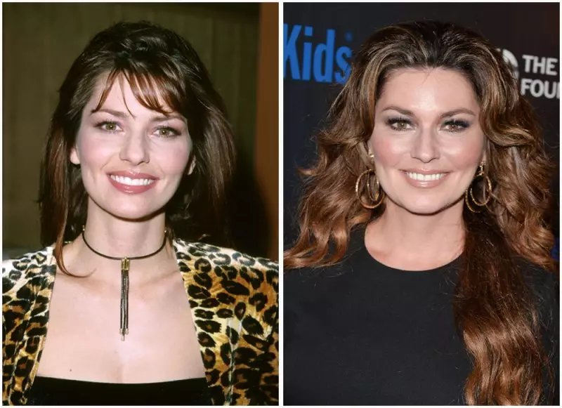 Shania two plastic surgery