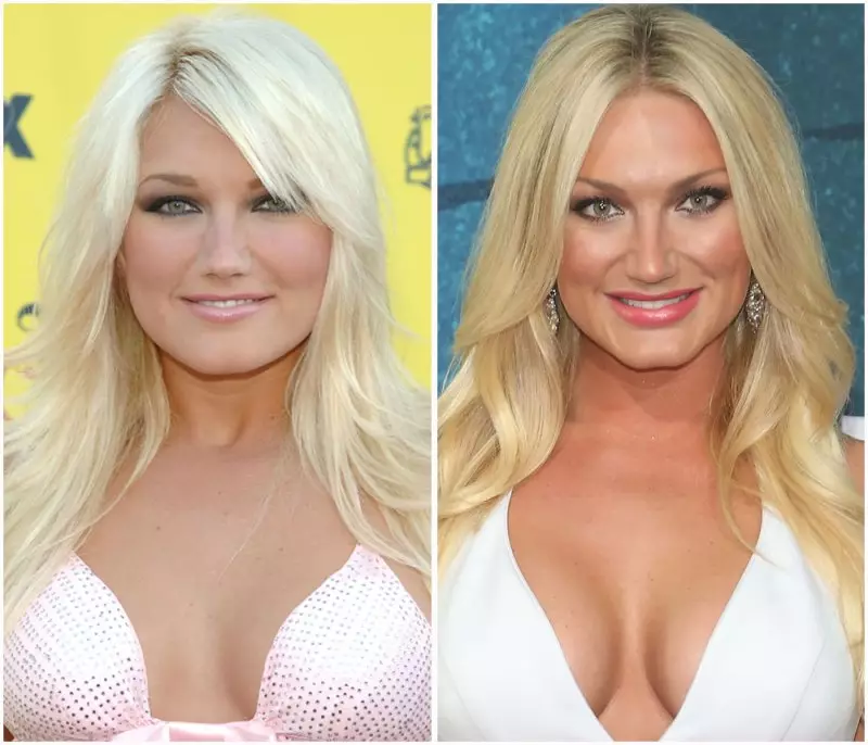 Brooke hogan plastic surgery