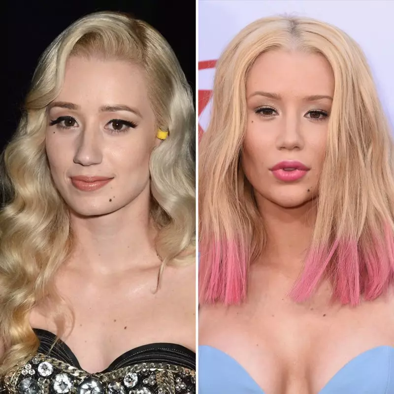 Iggy azalea хуванцар мэс засал