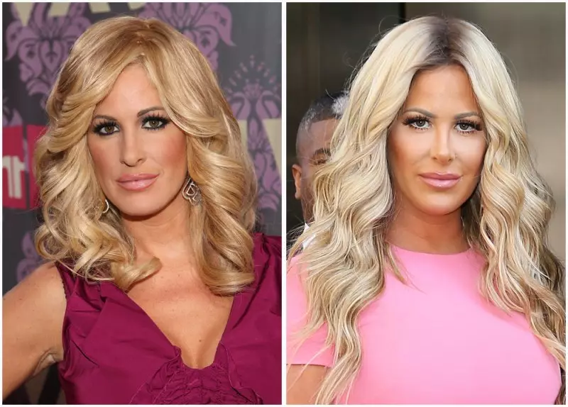 Πλαστική χειρουργική Kim zolciak