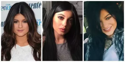 kylie jenner plastic surgery 2