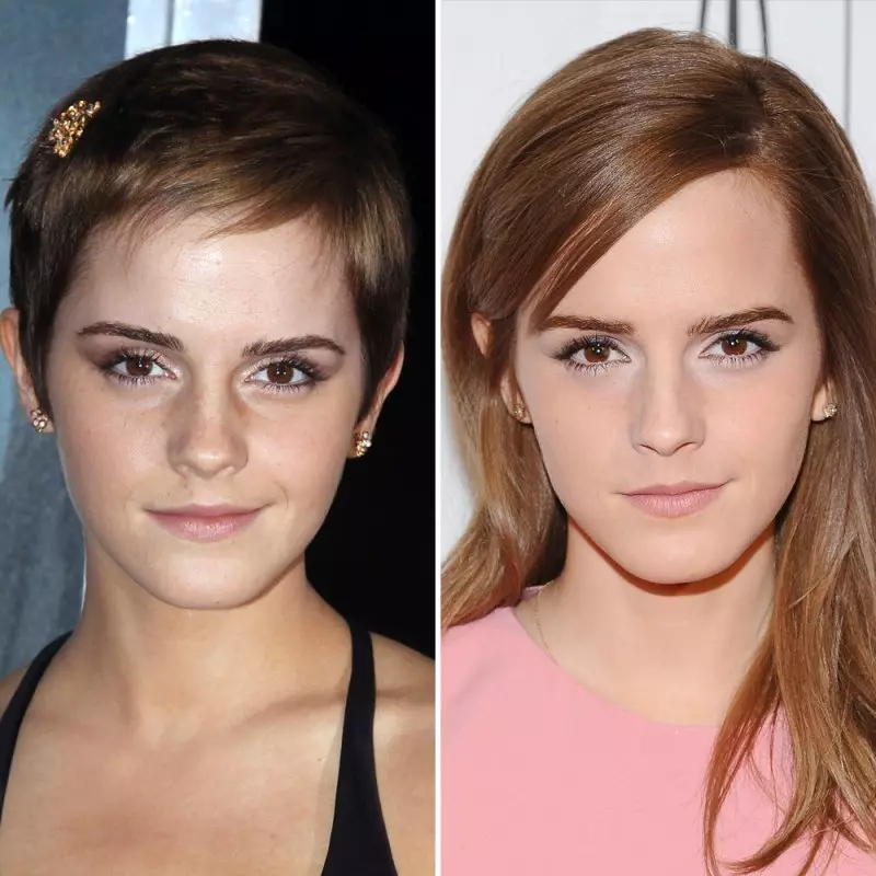 Emma Watson trumpi plaukai