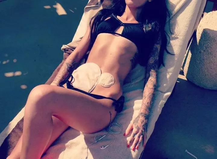 Ang modelo nagpakita sa colostomy bag bikini