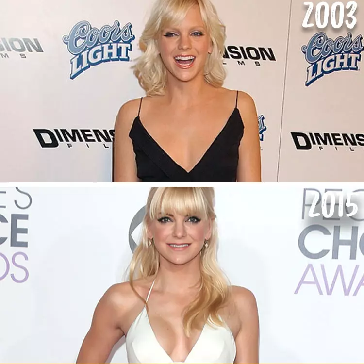 Anna faris boob transformacija službe