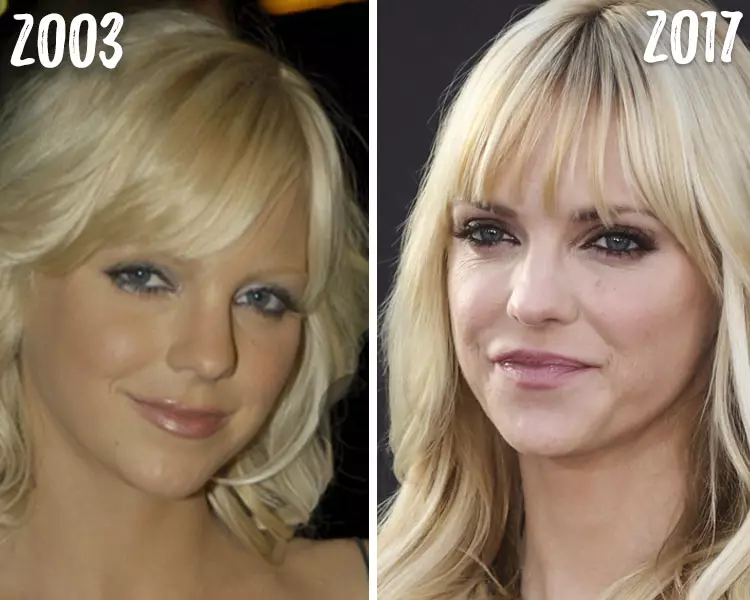 Transformation du menton d'Anna Faris