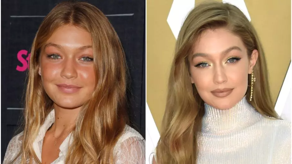 gigi-hadid-dies-plastic-surgery