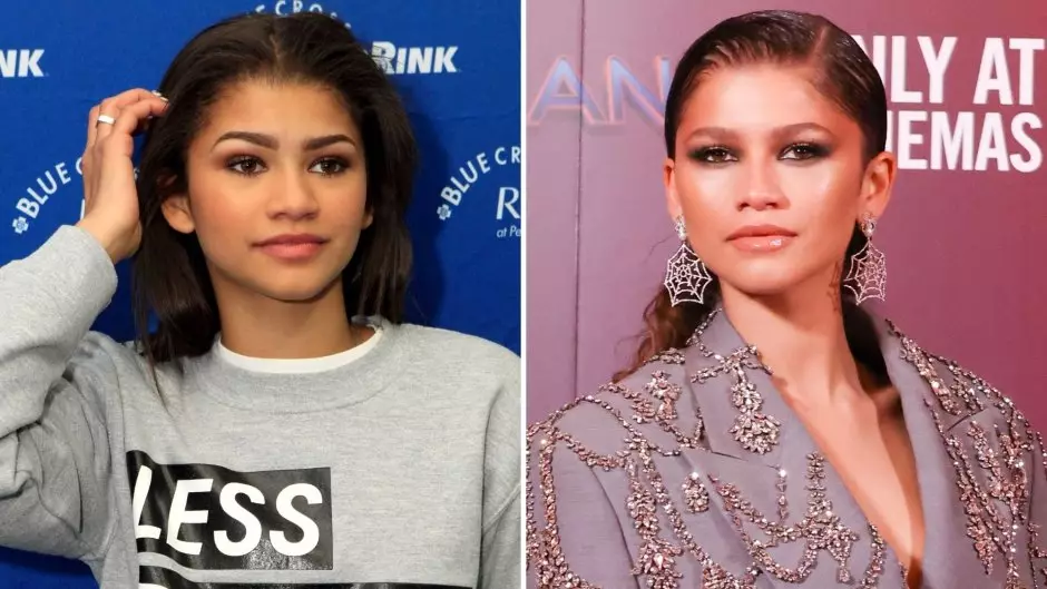 Zendaya har inte bekräftat plastikkirurgirykten bland spekulationer om näsjobb: Se bilder på henne