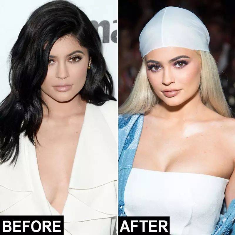 Kylie jenner transfòmasyon