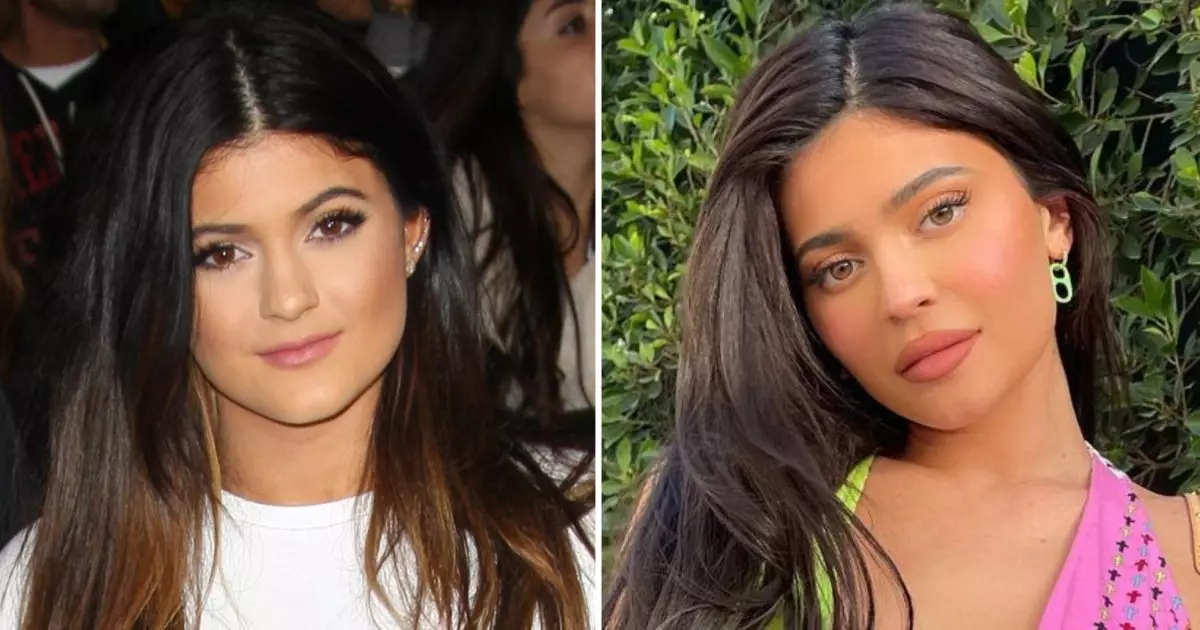 Kylie Jenner အသွင်ပြောင်းဓာတ်ပုံများ- သူမပြောင်းလဲပုံကိုကြည့်ပါ။
