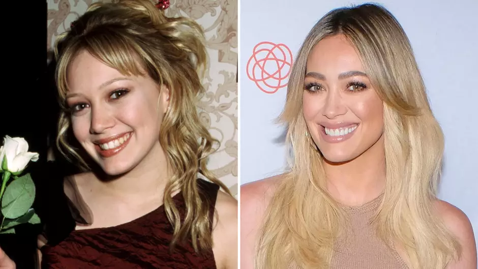 Hilary Duff ħadet kirurġija plastika? Ritratti Qabel u Wara