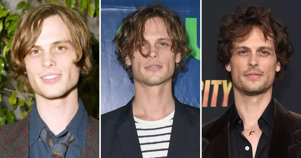 Matthew Gray Gubler ئۆزگەرتىش سۈرەتلىرى: كېيىن ۋە ھازىر رەسىملەر