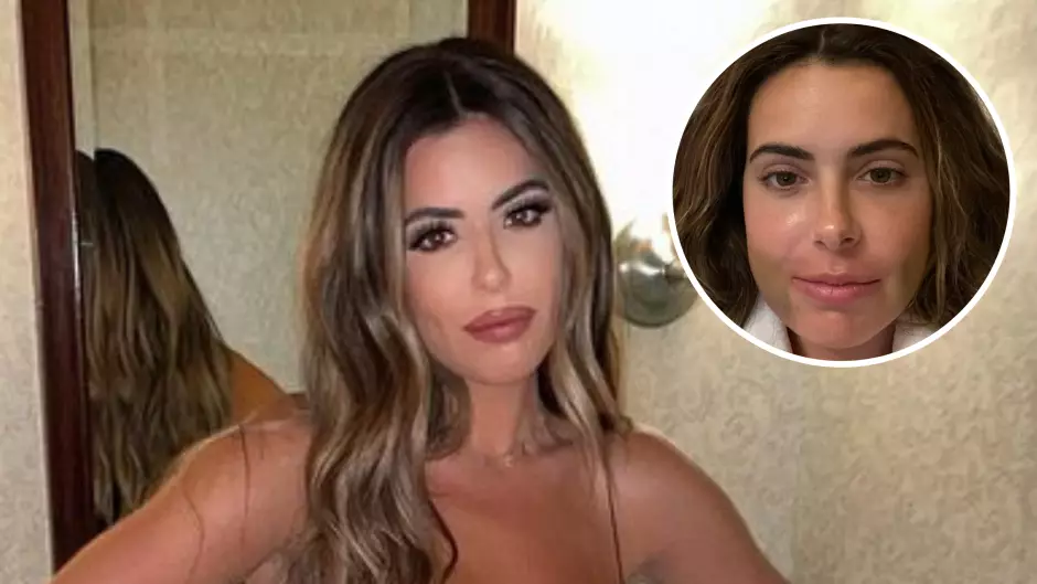 Brielle Biermann'ın Çift Çene Ameliyatı: Öncesi ve Sonrası Fotoğraflar