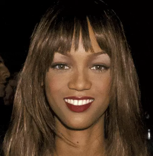 Plastická chirurgie Tyra