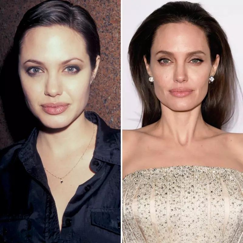 Angelina Jolie Nasenjob