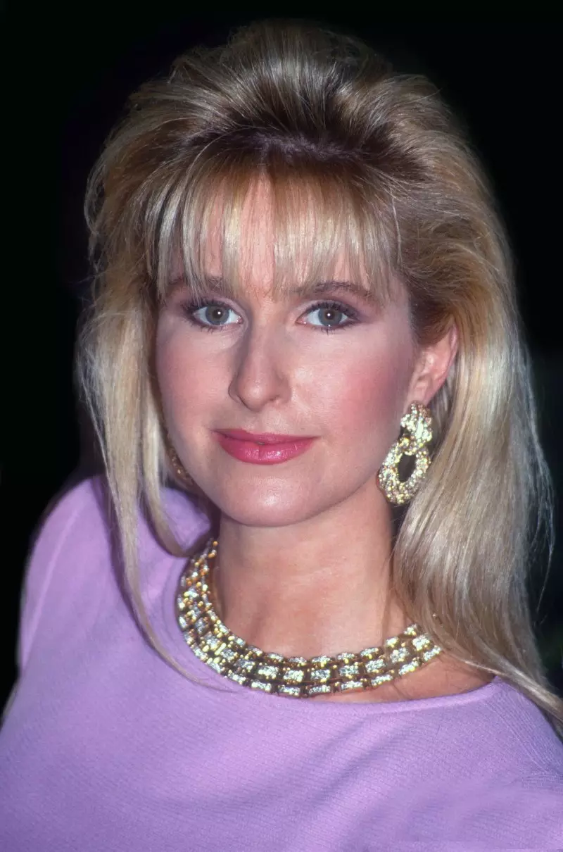 kathy-hilton-plasztikai sebészet-1990