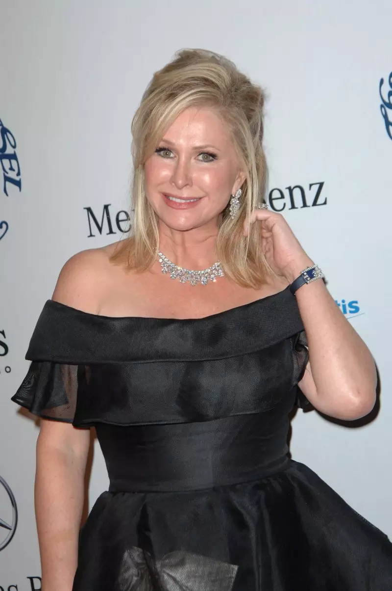 kathy-hilton-plastic-surgery-2010