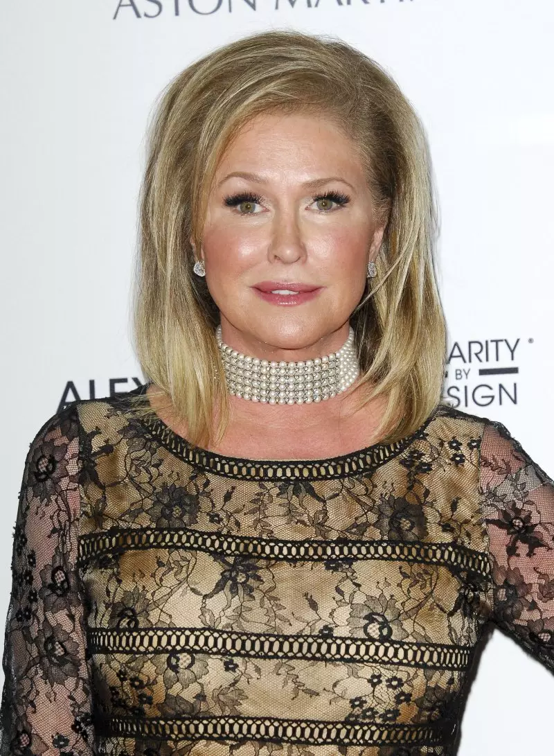 kathy-hilton-plasztikai sebészet-2015