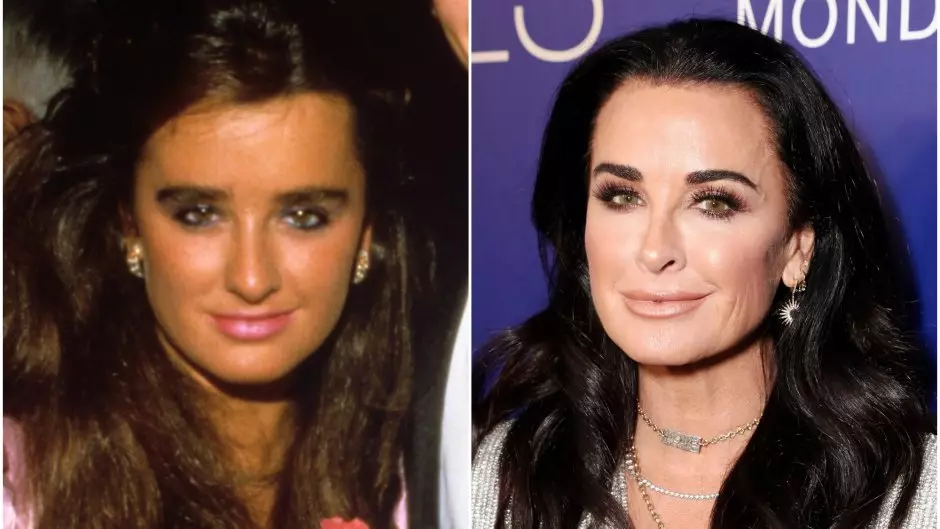 kyle-richards-rhobh-transzformáció