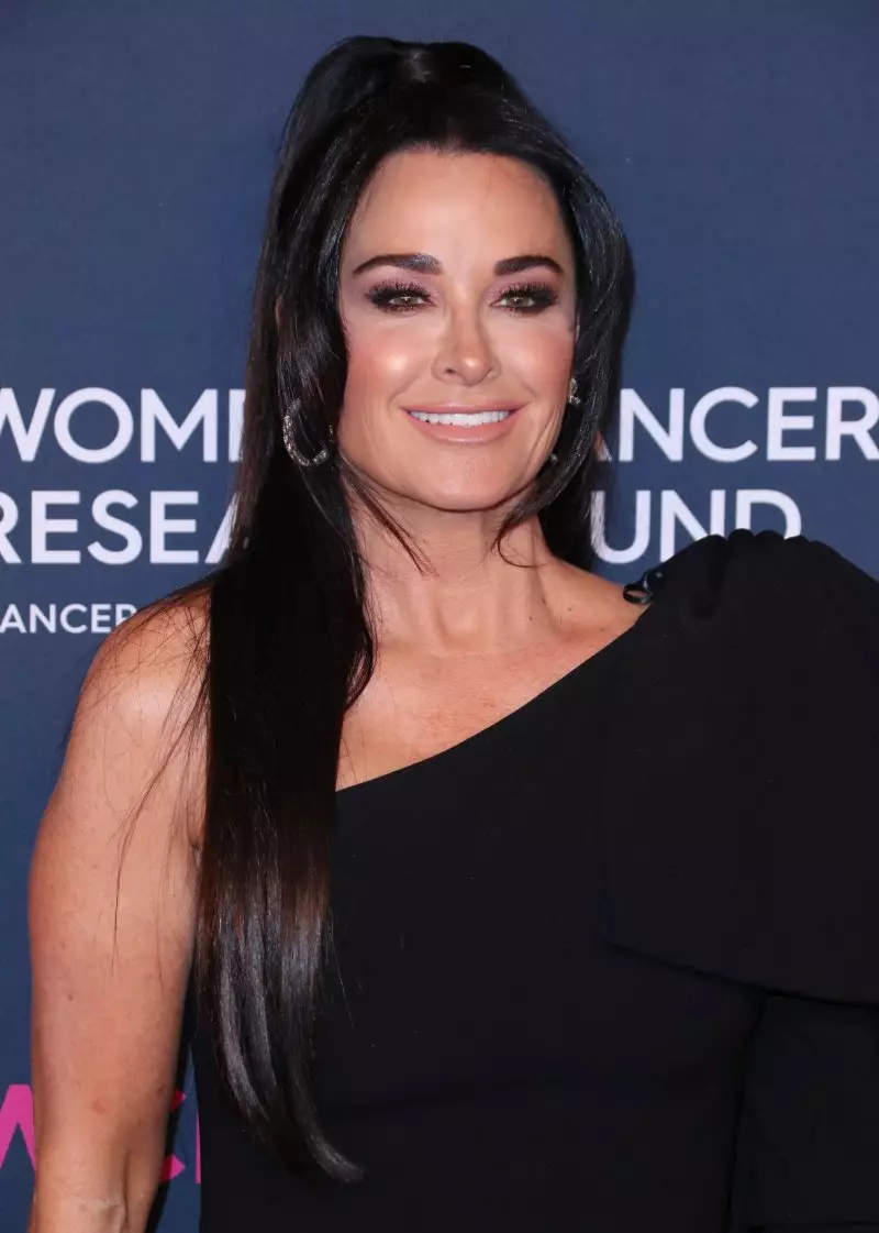 kyle-richards-rhobh-transzformáció