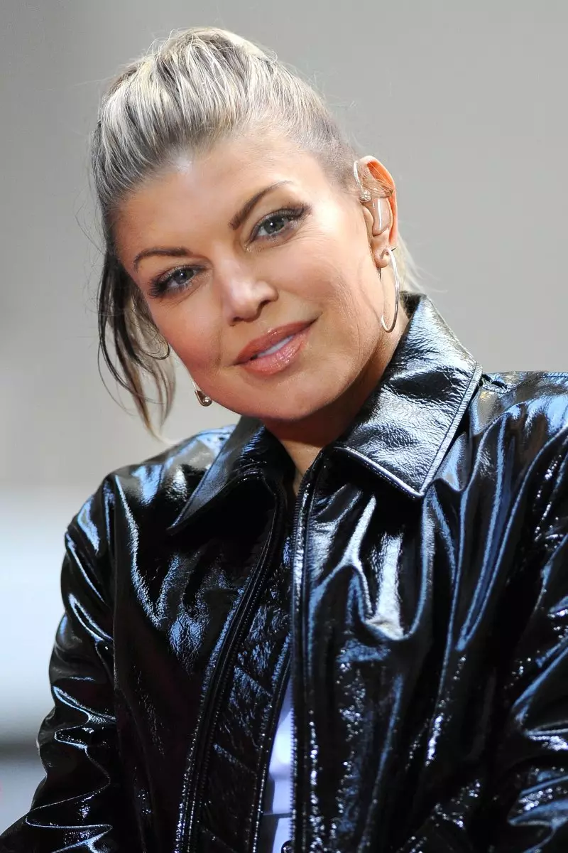 Fergie Plastic Surgery 2017