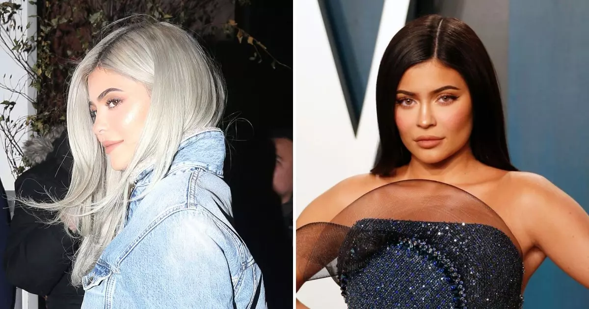 A bunda de Kylie Jenner é real? Veja fotos antes e depois
