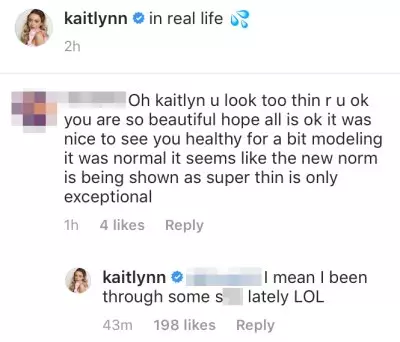 Kaitlynn Carter Fan Worries Too Thin